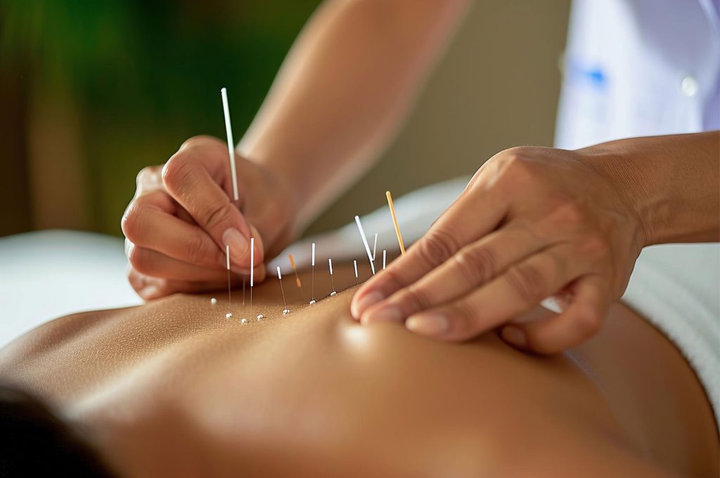 Acupuncture in Whitby, ON: Find Relief and Balance Today!